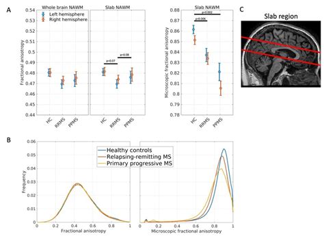 Group Average Fractional Anisotropy And Microscopic Anisotropy A Download Scientific Diagram
