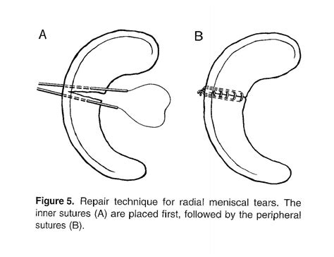 Open Vs Closed Chain Exercises For The Knee Myths Realities And