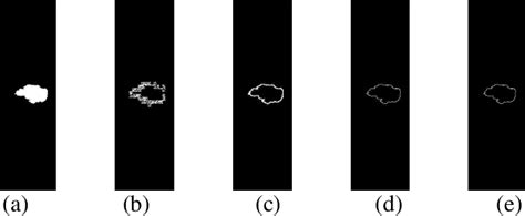 Figure 3 From Rail Defect Edge Detection Based On Improved Canny