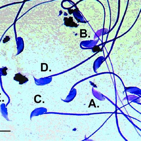 Spermatozoa With An Intact Head Membrane And Acrosome Arrow Shows A