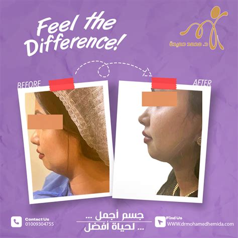 Gallery Dr Mohamed Hamida