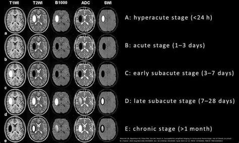 Mri Cases Radiology Radiography Shoulder Radiologist