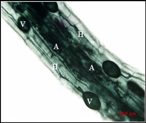5 Percent Root Length Colonized By G Mosseae Gm In 6 Week Old Download Scientific Diagram