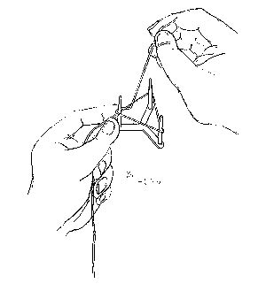 Ligation In Continuity In Laparoscopic Surgery