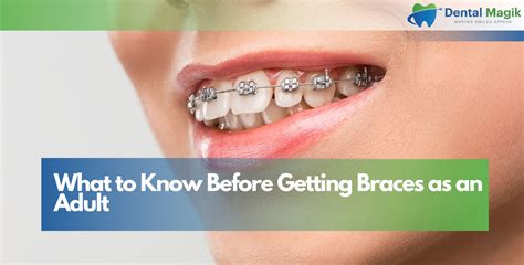 What To Know Before Getting Braces As An Adult Dental Magik