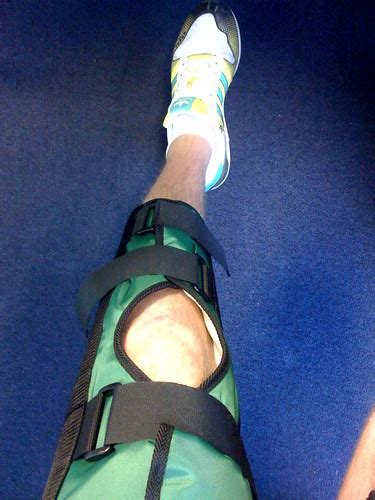 How Long In Brace After Mpfl Reconstruction And Why