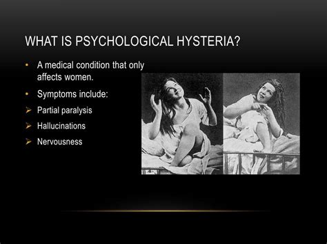 Ppt Psychological Aspects Of Hysteria Group Hysteria Powerpoint