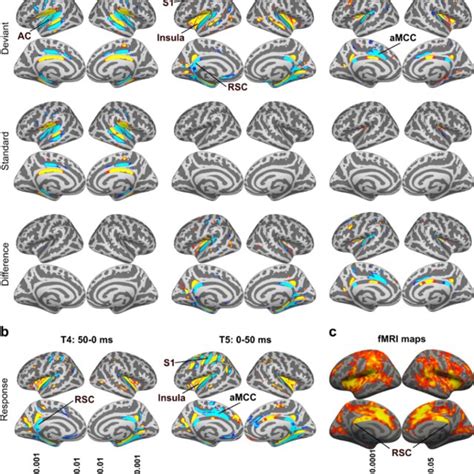 Multi Source Simulation For The Stimulus Locked N1 And P3 A Grand