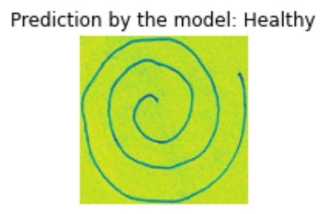 Parkinsons Disease Detection Using Spiral Drawings And Cnn By Ai Technology And Systems Aits