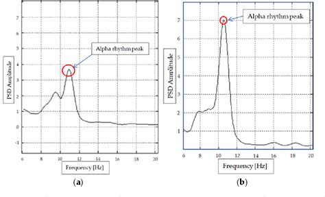 Figure 4 From Driver Drowsiness Multi Method Detection For Vehicles