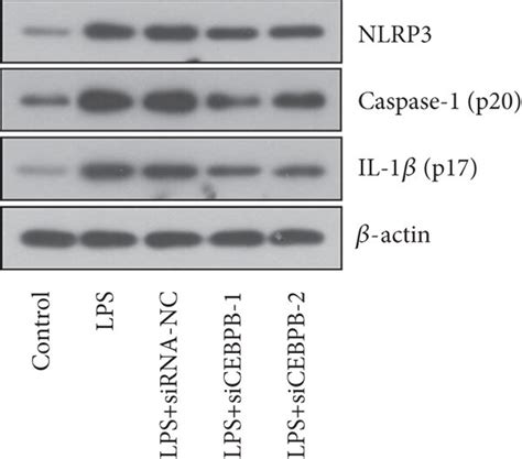 The Knockdown Of Cebpb Inhibited The Activation Of Nlrp3 Inflammasomes