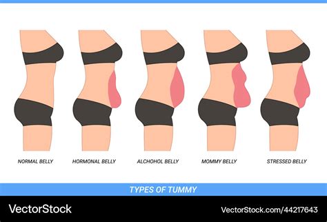 Types Of Tummies For Woman Royalty Free Vector Image