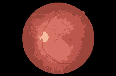 Python Calculate The White Pixel Inside Cv2circle Stack Overflow