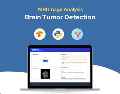Multi Class Brain Tumor Detection Using Deep Learning Raisalon