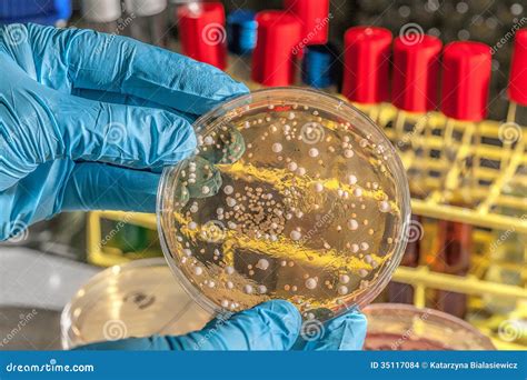 Agar Plate With Fungi Microorganisms Royalty Free Stock Photography Cartoondealer Com