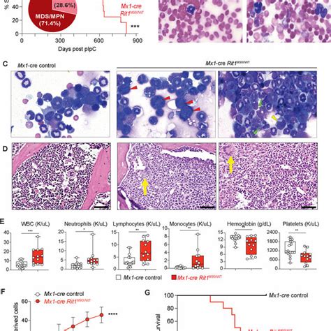 Rit1 M90iwt Mutation Drives Development Of Myeloid Neoplasms In Vivo
