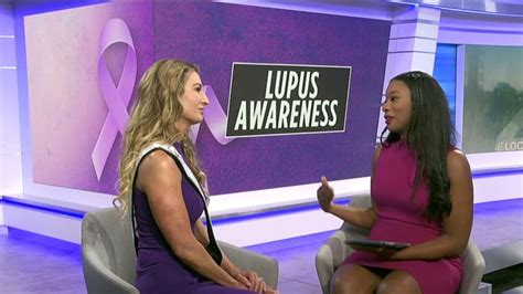 Amanda Devoe Lupus Ambassador Share Experiences On World Lupus Day