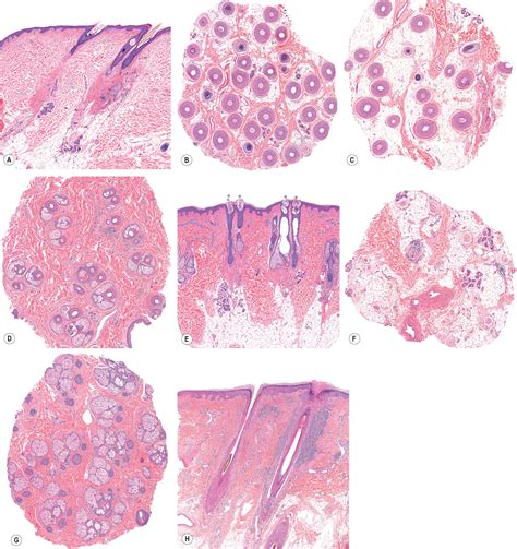Alopecias Clinical Tree