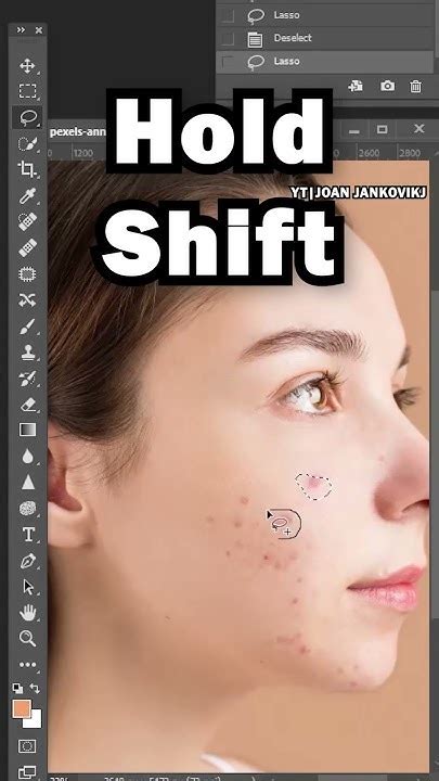 Easy Way To Remove Acnes In Photoshop Shorts Youtube