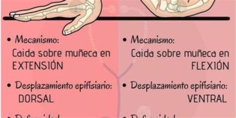 Diferencia Entre Fractura De Colles And Fractura De Smith Blog De Fisioterapia