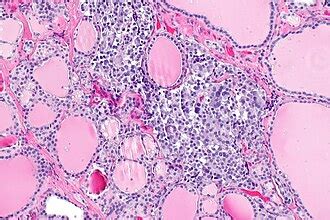 Thyroid Histology C Cells
