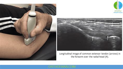 Elbow Ultrasound Imaging Orthopedic Learning