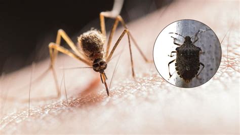 ¿cuáles Son Las Diferencias Entre La Picadura De Mosquitos Y Chinches
