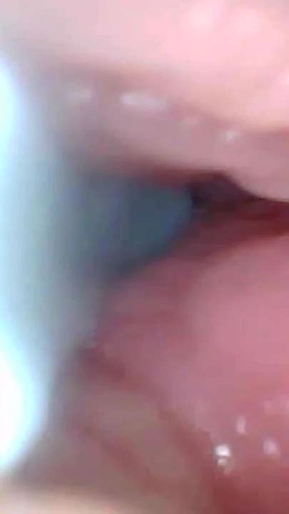 Must See Moment From First Time An Endoscope Reveals The G Spot Up Close Without Mountingl