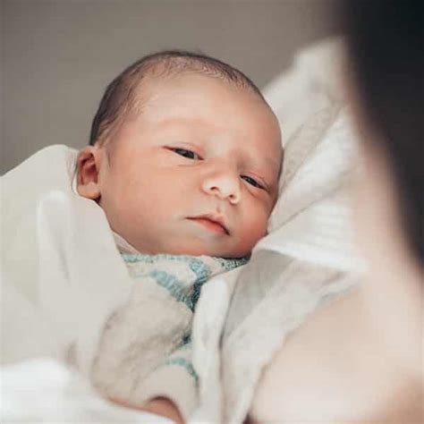 ¿qué Es La Microcefalia En Un Bebé Síntomas Y Posibles Causas