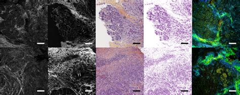 comparison between static ff oct dynamic ff oct and histology images