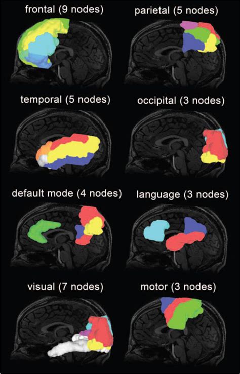 Eight Resting State Brain Networks Utilized To Investigate Disrupted
