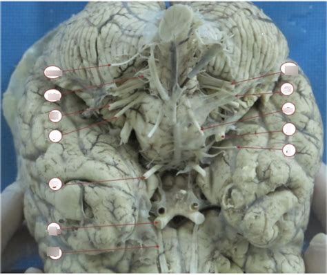 Craniale Zenuwen Diagram Quizlet