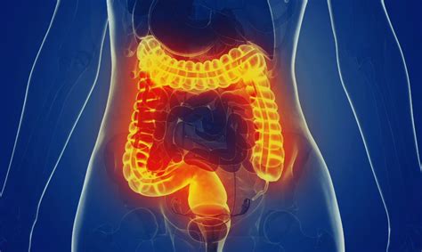 40 Facts About Regional Enteritis