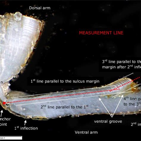 Otolith Transverse Section Through The Primordium Of An Atlantic Download Scientific Diagram