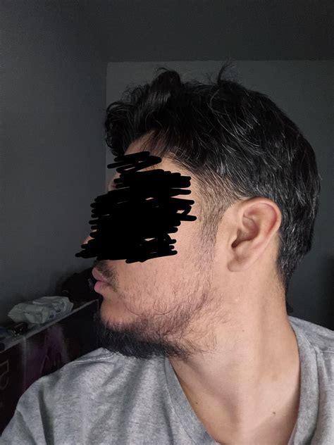 Dont Have The Best Facial Genes Should I Continue To Let It Grow Or Pick A Style That I Cam Work