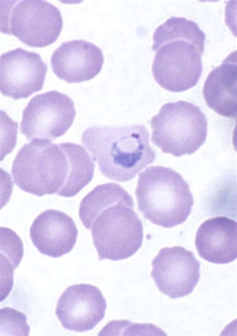 Apicomplexa Plasmodium