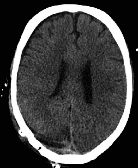 Post Operative Control Ct Download Scientific Diagram