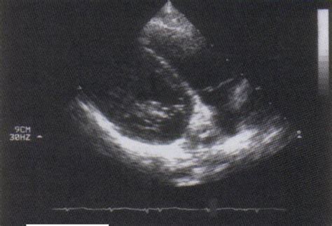 Rvot Labeling Diagram Quizlet