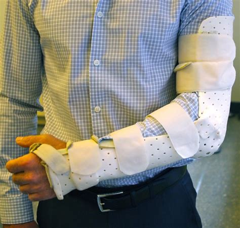 Splint For Olecranon Fracture Or Wrist Surgery Grand Central Physical