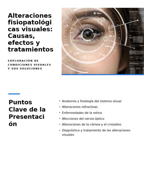 Alteraciones Visuales Estudiantes Pdf Ojo Humano Glaucoma