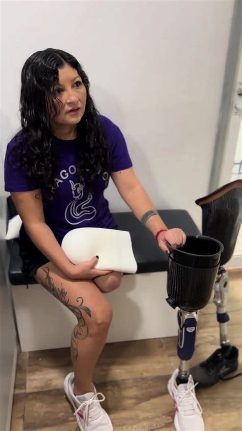 Amputee Girl Puts On Prosthesis