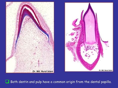 Dentin Pulp Complex Ppt