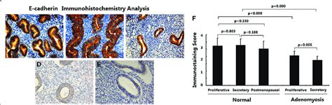 Immunoexpression Of Protein E Cadherin In Normal Endometrium And