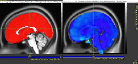 3dtcorr1d Afni Message Board Afni Discuss Message Board