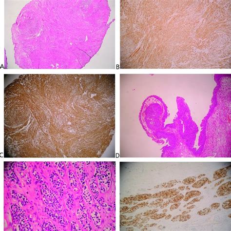 Pathological Slides Of Common Histopathological Variants Rate Above Download Scientific