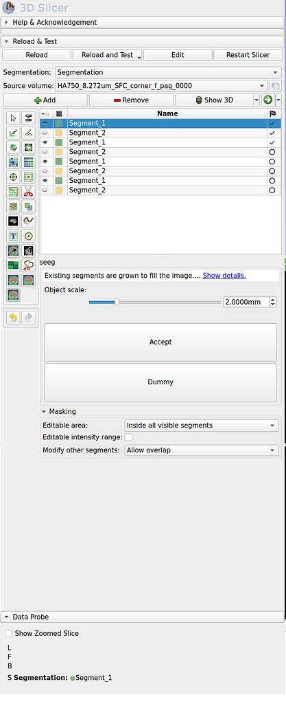 how to add additional buttons to scriptedsegmenteditoreffect