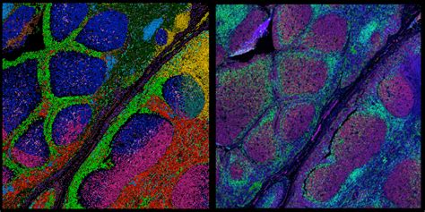 Spatial Proteomics And Deep Visual Proteomics A Revolution In Cell