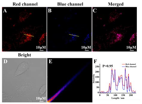 Visual Tracking Of Hydrogen Sulfide Application Of A Novel Lysosome Targeted Fluorescent Probe