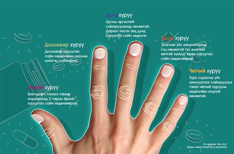 Хуруугаараа эмчлэх арга News Mn