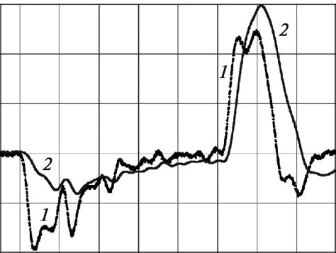 Waveforms Of 1 The Accelerating Voltage And 2 The Total Current In